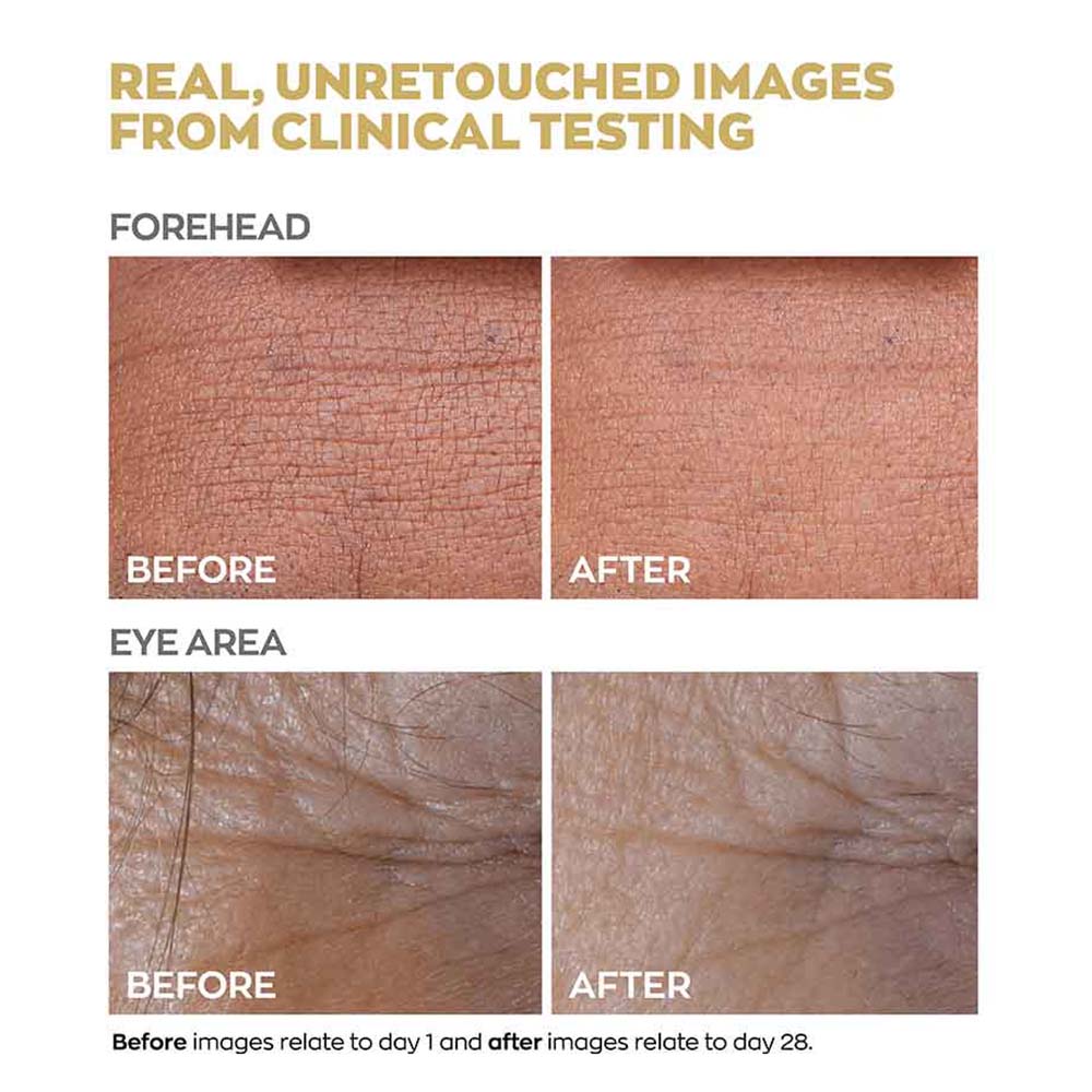 Avon Protinol™ | Anew Protinol™ Power Serum | AVON UK