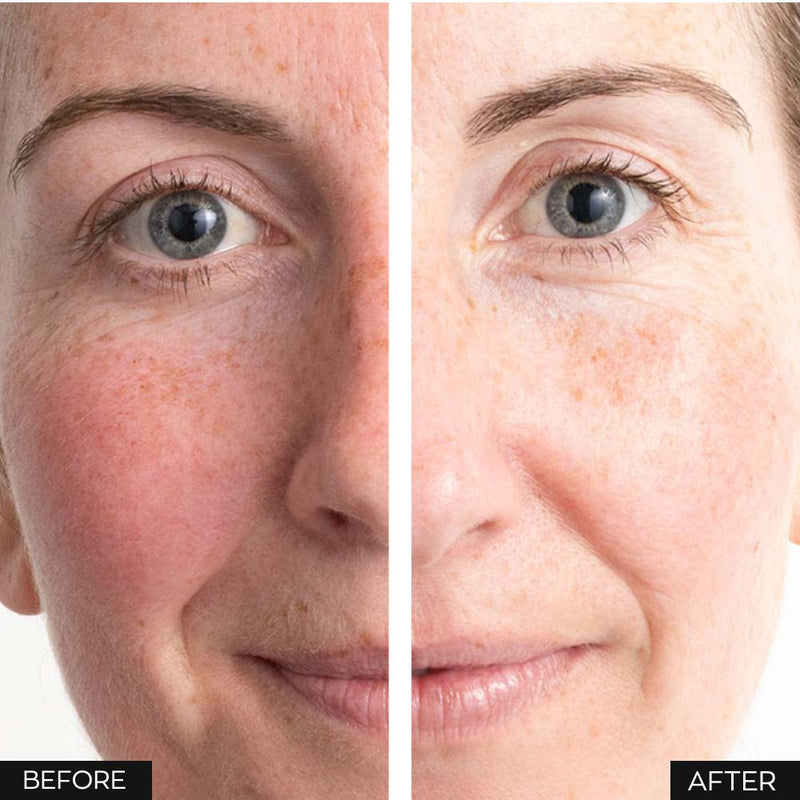 Avon Protinol™ | Anew Protinol™ Power Serum | AVON UK